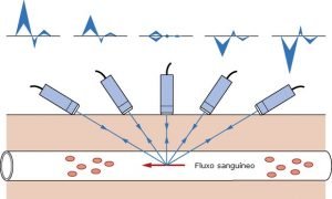 4 tipos de Doppler e a importância do exame para diagnóstico